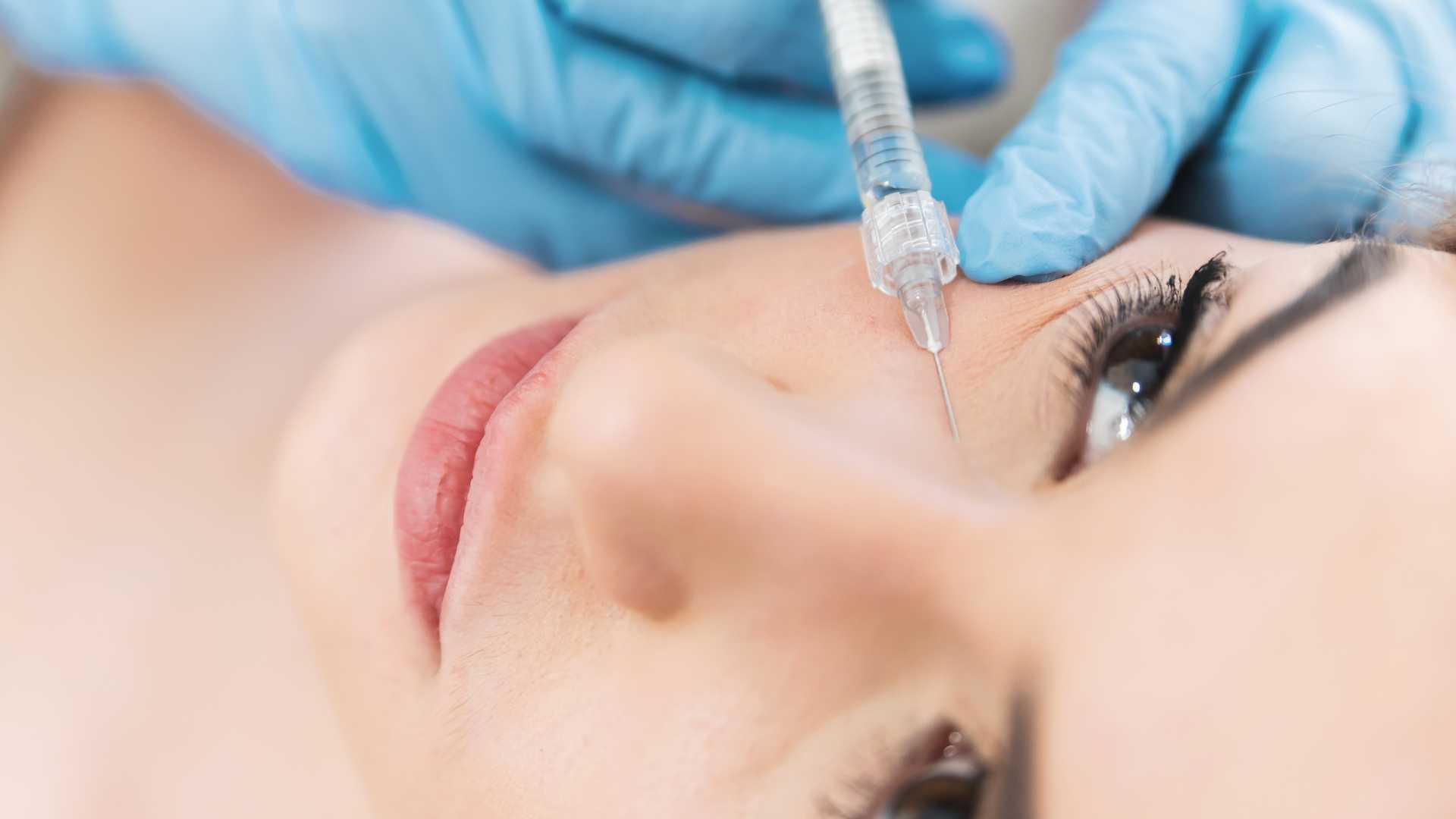 Apa Itu Filler dan Segala yang Perlu Anda Ketahui - Q Derma Clinic